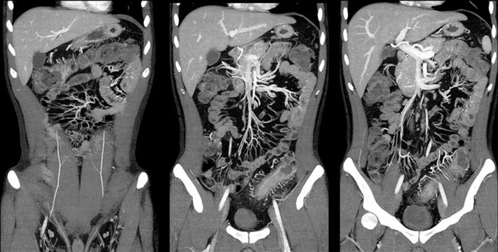 CT Abdo 2 - Canberra Imaging Group