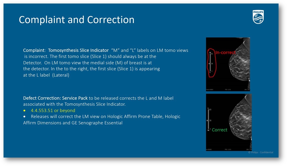 MAMMO2 - Canberra Imaging Group