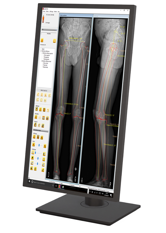 EOS - Canberra Imaging Group