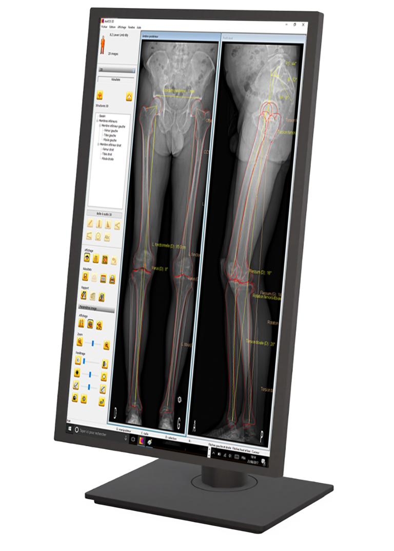 EOS - Canberra Imaging Group